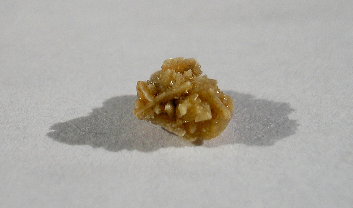 Advanced Treatments for Kidney Stones: What to Expect - Top Urologist NYC